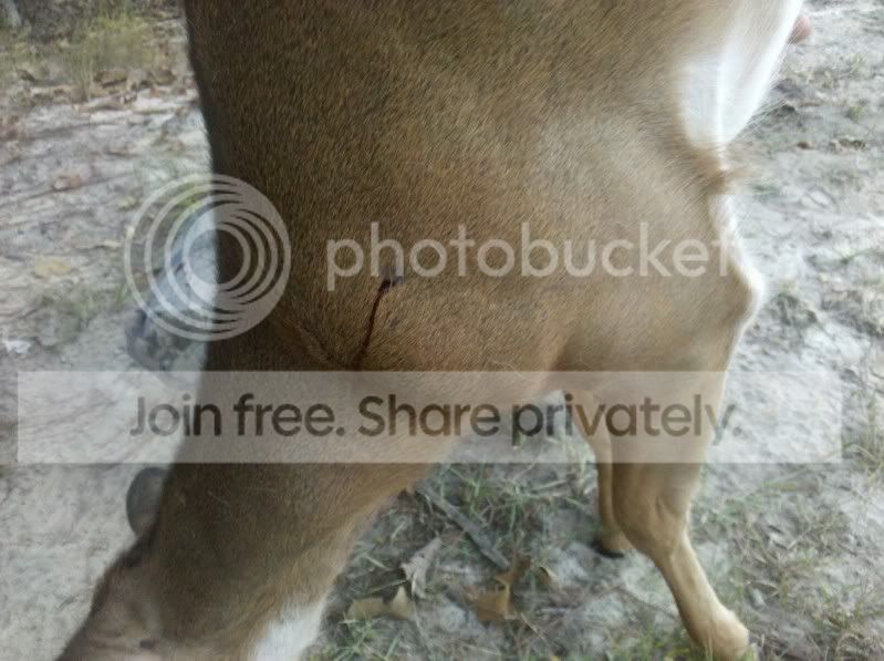 Show us your entry and exit wounds! > Deer Hunting > AR15.COM